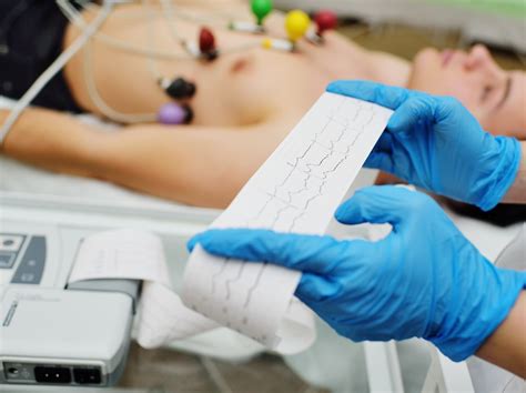 Electrocardiograma Qué es Guía Médica