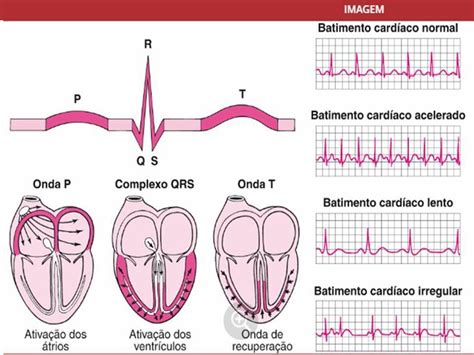 O Que é Ecg Convencional SOLOLEARN