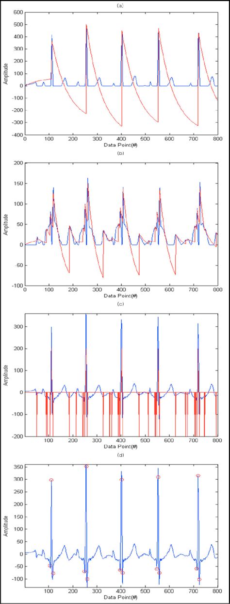 figure 1 from classification of ventricular arrhythmia using a support vector machine based on
