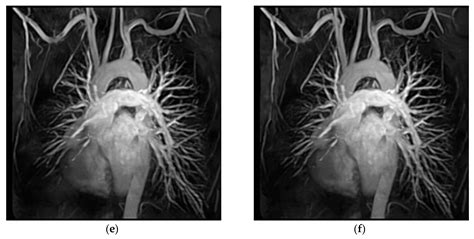 entropy free full text an entropy based algorithm with nonlocal residual learning for image