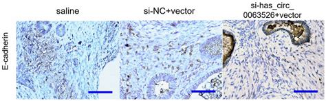 Knockdown Hsa Circ Inhibits Endometriosis Progression Via