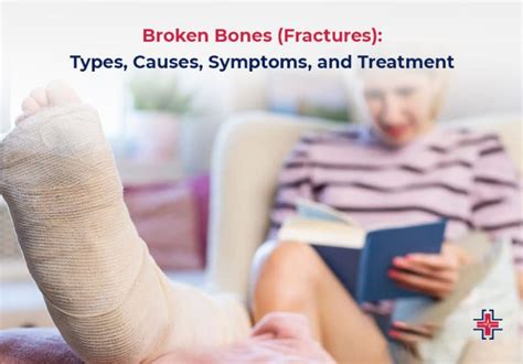 Broken Bones Fractures Types Causes Symptoms And Treatment ER