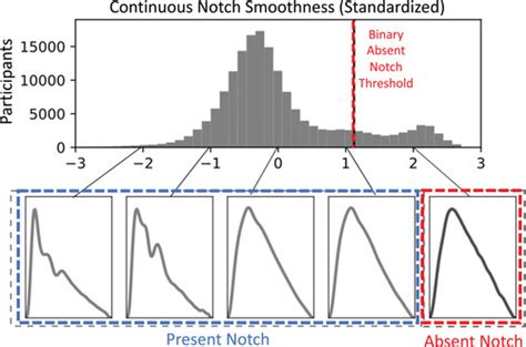 machine learning to understand genetic and clinical factors associated with the pulse waveform