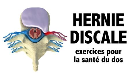 Hernie discale exercices pour la SANTÉ du DOS YouTube