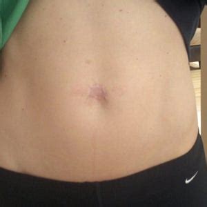 People Without Belly Buttons