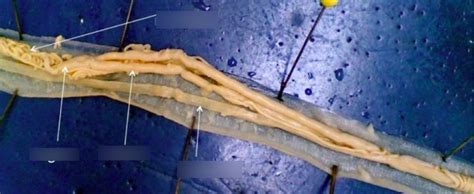 Lab Exam Iii Ascaris Dissection Female Diagram Quizlet