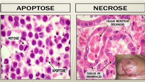 Vias da necrose e da apoptose Fonte Site Nutrição e Informação