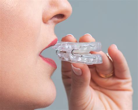 APARELHO INTRAORAL PARA TRATAMENTO DO RONCO E APNEIA DO SONO