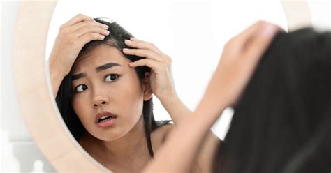 Alopecia Por Estr S Por Qu Sucede Y C Mo Tratarla Salud