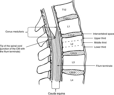 Changing Body Position Alters The Location Of The Spinal Cord Within