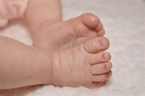Fotos gratis dulce pierna pequeña niño brazo uña tomados de la
