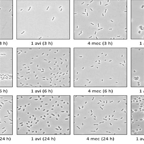 Spherical Structures Of The K Pneumoniae Strain Kp Observed In Vitro