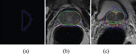 figure 1 from 3d prostate segmentation from mri images using modified rotational slice based
