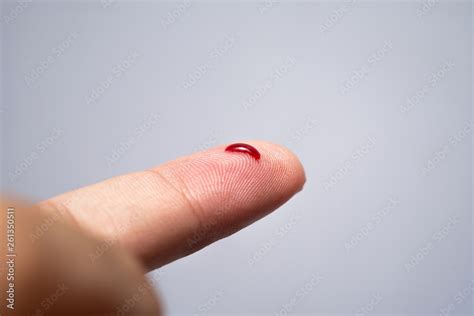 Bleeding Blood From The Cut Finger Wound Injured Finger With Bleeding