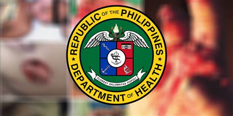 DOH 137 Fireworks Related Injuries Naitala Sa Bansa
