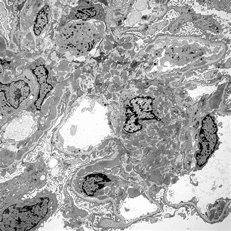Electron Microscopy