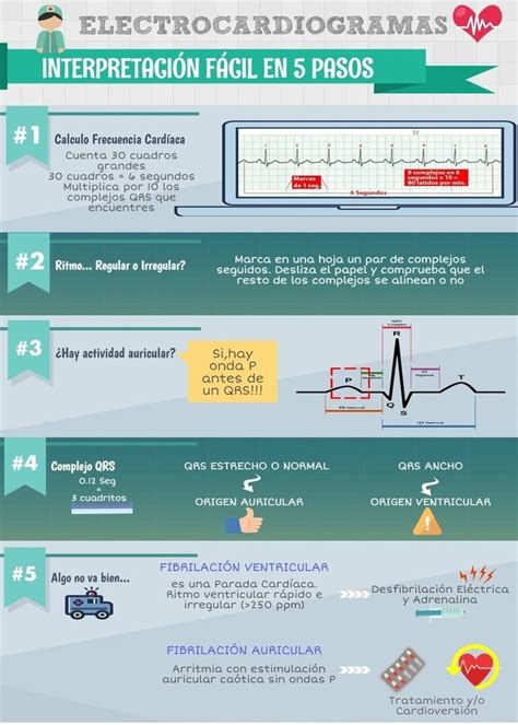 herramientas enfermeria INTERPRETACIÓN DEL ELECTROCARDIOGRAMA EN 5 PASOS