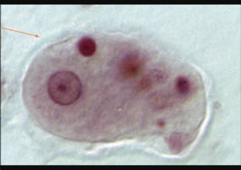 The Protists Pt 1 Ch 3 Flashcards Quizlet