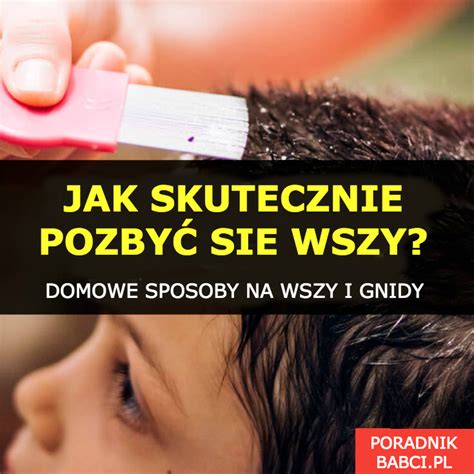 Wszawica Domowe Sposoby Na Wszy I Gnidy 100 Skuteczne