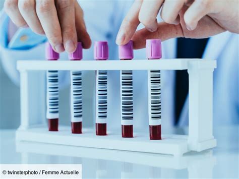 HbA1c quel est le taux normal dhémoglobine glyquée Femme