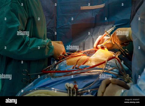 Im Operationssaal eines Krankenhauses wird für Herzoperationen