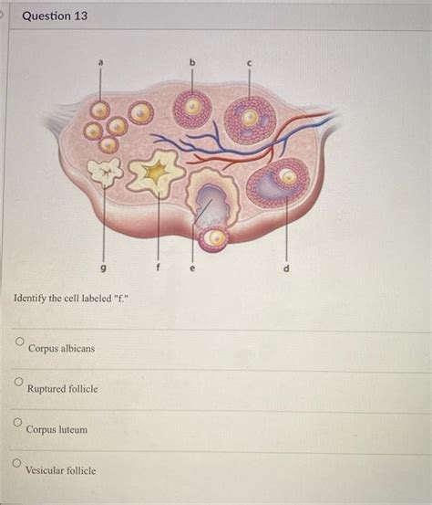 Solved Identify The Cell Labeled F Corpus Alb