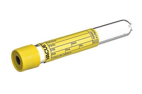 Zkumavka VACUETTE 10ml na moč žlutá zátka sterilní 50ks MEDICROSS CZ
