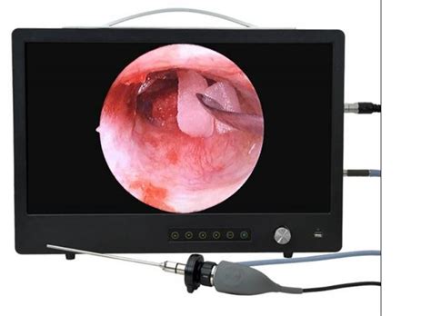 Laparoscopy Camera Full HD 1080P Endoscope Camera System All In One HD
