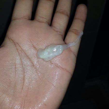 Mucus Plug Picture Babycenter