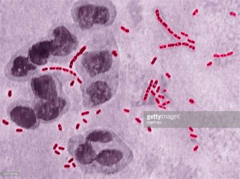 Genital Ulcers And Hyperplasias Vagiitis And Vulvovaginitis Genital