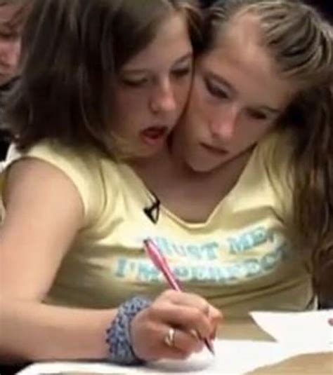 Photos 15 choses que vous ignorez sur les célèbres soeurs siamoises