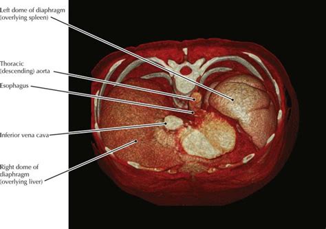 Thorax Radiology Key