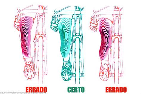 Dor No Joelho Ao Pedalar Dr Márcio Silveira