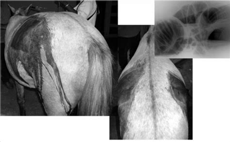 Obstruction Of The Small Intestine Caecum And Large Intestine
