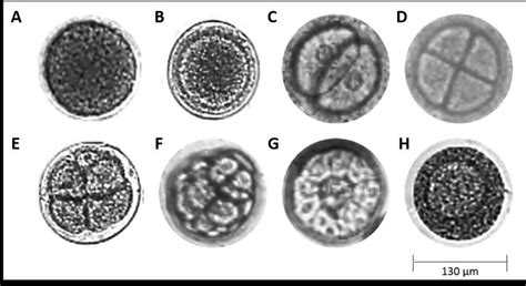 Blastula Sea Urchin