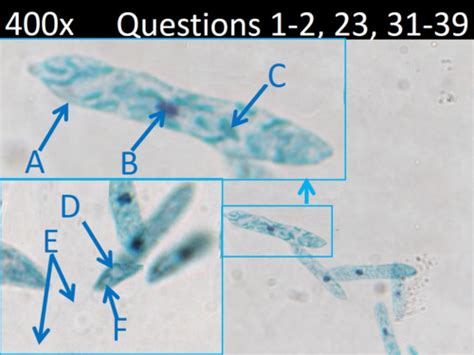 Protists Lab Flashcards Quizlet