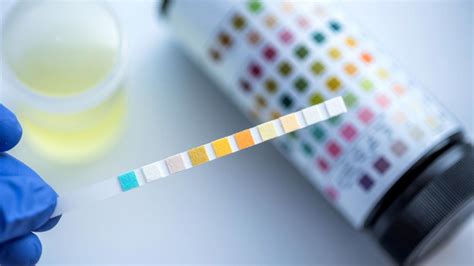 Colore Delle Urine In Caso Di Infezione Delle Vie Urinarie