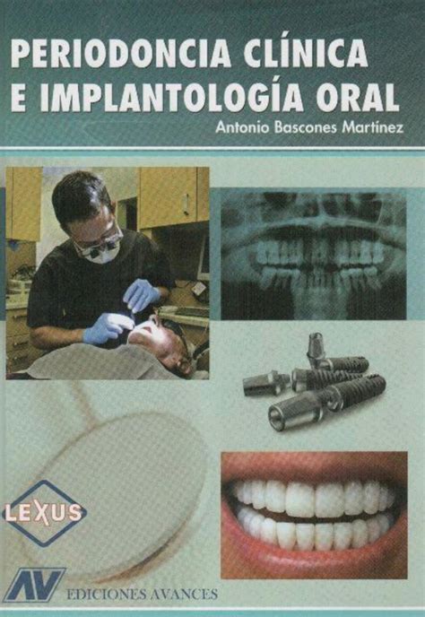 Periodoncia clínica e implantologia oral