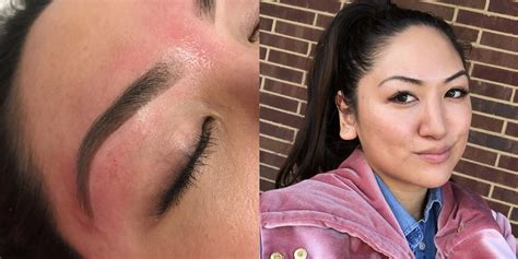How To Hide A Scab On Your Face With Makeup Saubhaya Makeup