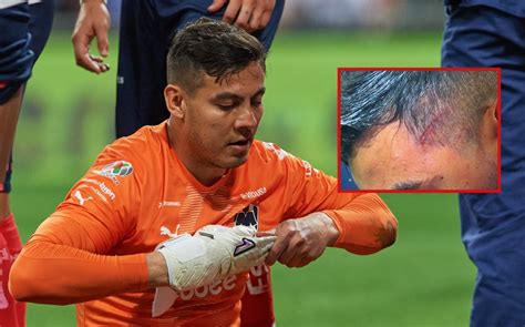 Portero De Monterrey Recibe Patada Y Rodillazo En Partido Ante Santos