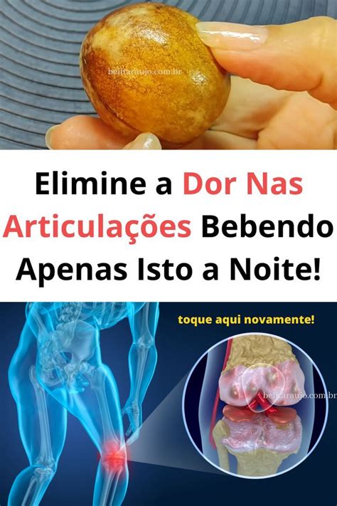 ESSA RECEITA TRATA ARTRITE ARTROSE REUMATISMO e CIRCULAÇÃO fevereiro