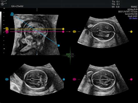 OB GYN Ultrasound Is The Field Ready To Adopt New Technology In The