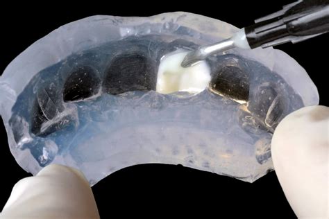 Quand Utiliser Un Silicone Transparent Applications Cliniques