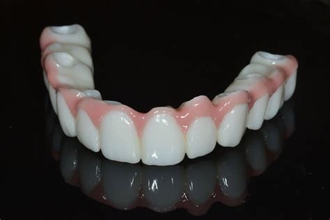 Full Arch Fixed Zirconia Dental Implant Bridge Portsmouth NH Dentist