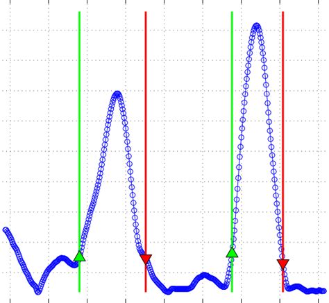 segmentation of the primitive action download scientific diagram