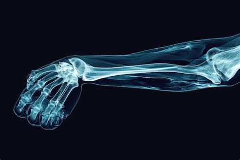 Рентгеновское изображение руки держащей объект детальный 3d обзор
