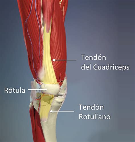 Tendinitis Rotuliana Rodilla Del Deportista 2