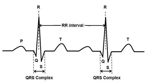 r wave qrs complex and rr interval in standard ecg signals download scientific diagram