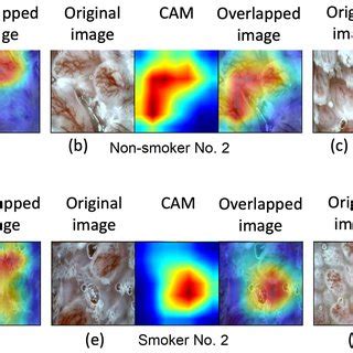 Results Of Class Activation Map Cam Visualization For Convolutional