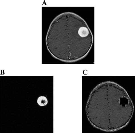 an efficient lossless roi image compression using wavelet based modified region growing algorithm
